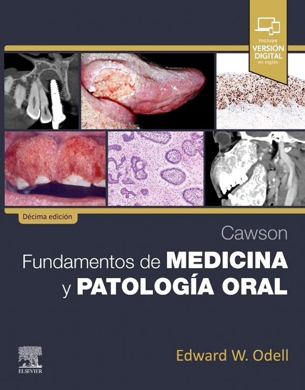 Descubre Cawson: Patología Oral 10ª Ed – Mediterraneo Chile